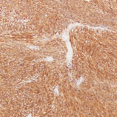 Cd117 Antibody Reagent For Immunohistochemistry Primary Antibodies