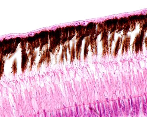 Outer Layers Of Retina Stock Image Image Of Histology 303600561