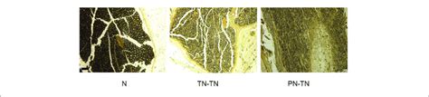 Osmic Acid Staining The Myelinated Nerve Fibers In The N Group Were