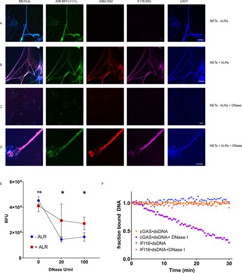 The Dna Sensors Aim2 And Ifi16 Are Sle Autoantigens That Bind Neutrophil Extracellular Traps Pmc
