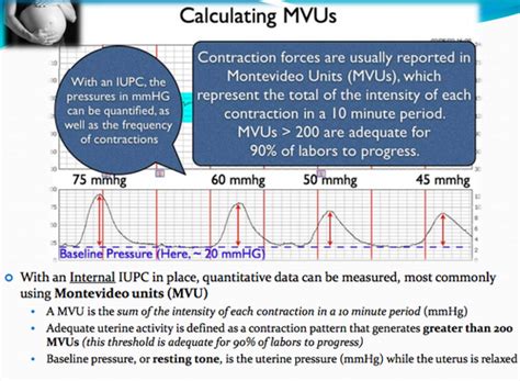 Fetal Assessment During Labor And Pain Flashcards Quizlet