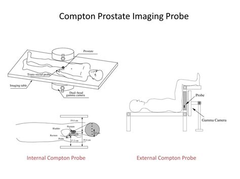 Ppt Prostate Probe With Spect Technique Powerpoint Presentation Free