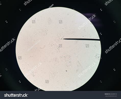 Mucus Threads In Urine Men Mucus Threads In Urine Men