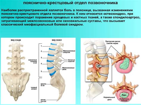 Мышцы поясницы - online presentation