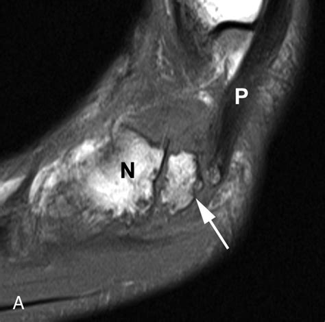 Foot And Ankle Clinical Tree