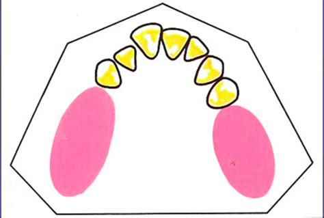 Kennedy Classifications Flashcards Quizlet