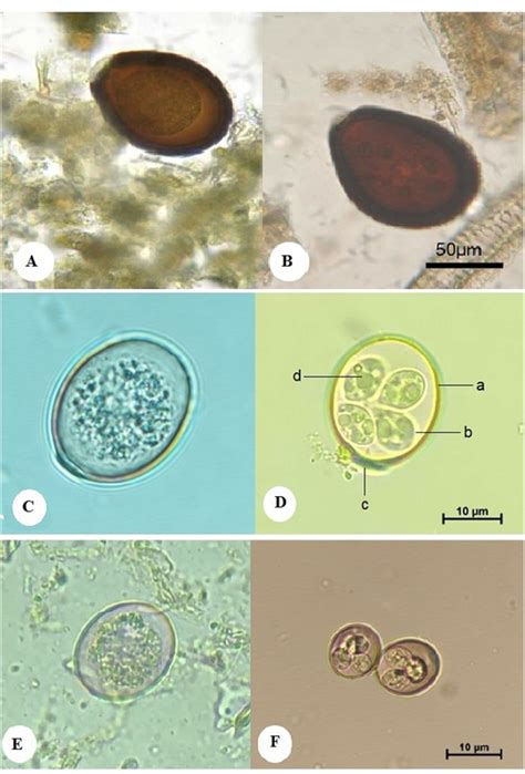 Morphological Characteristics Of Isolated Eimeria Spp Showing E