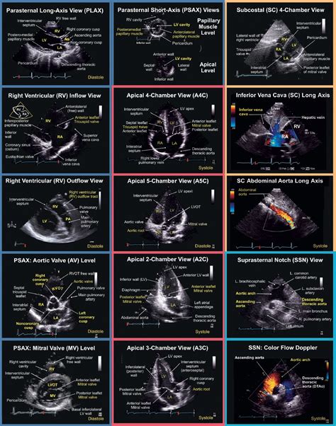 Echocardiogram Segments Echocardiogram Carolina Heart And Leg Center
