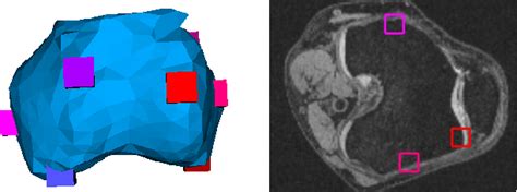 Figure 1 From Automated Anatomical Landmark Detection Ondistal Femur