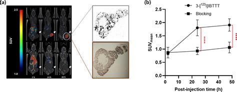 Development Of A Novel Prosthetic Click Linker For Radioiodination Of Antibody Based
