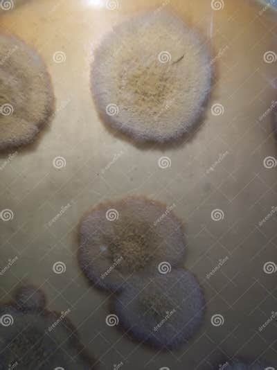 Trichoderma Viridae Young Colonies Stock Image Image Of Young Fungal