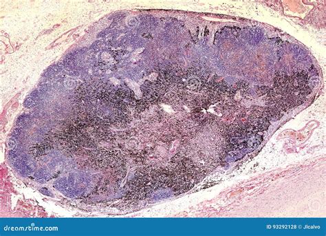 Lymph Node Cells Under The Microscope Royalty Free Stock Image