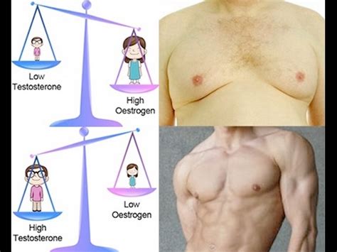 Estrogen And Gynecomastia Man Boobs 2017 Increase Testosterone And