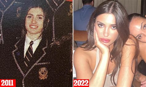 Bianca Censori Plastic Surgery Unraveling The Mysteries Behind