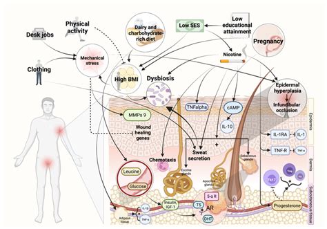 The Main Trigger Factors Involved In Hs For A Detailed Explanation