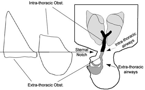 Spirometry Springerlink