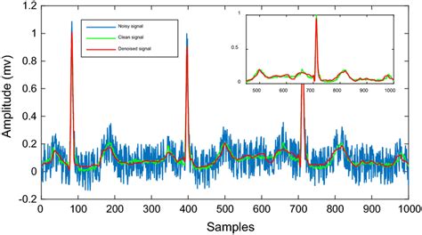 the denoised result for muscle noise at input snr 5 db download high