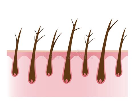 Scalp Layer Stock Illustrations 1 131 Scalp Layer Stock Illustrations Vectors And Clipart