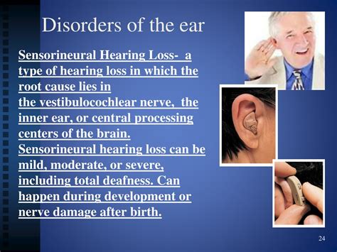 Ppt Ears Powerpoint Presentation Free Download Id270840