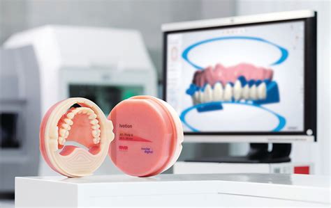 Ivotion Denture System Streamlines Workflow