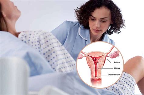 Bị polyp cổ tử cung có quan hệ được không Làm sao để chữa trị Nhà thuốc FPT Long Châu