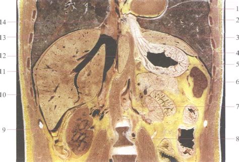 图4 4 经食管腹部的冠状断面1 腹部外科临床解剖学