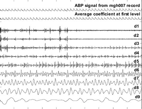 Wavelet Decompositio Structure Of Mgh001 Using Db4 Wavelet Analysis