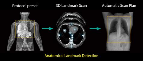Instinx Workflow Automation Computed Tomography Ct Scanners Canon Medical Systems Usa