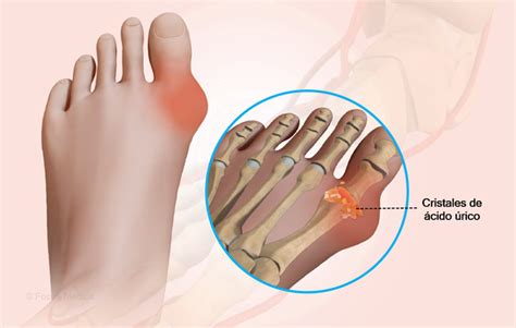 Health Condition Symptoms Causes Treatment And More