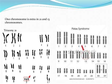 Numerical Chromosomal Aberrations