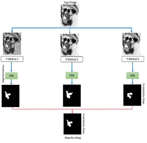 Figure 1 From Boosting Cnn Learning By Ensemble Image Preprocessing Methods For Cervical Cancer