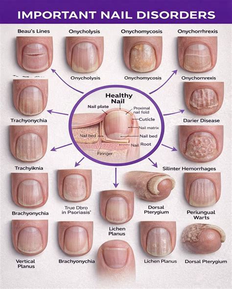 Different Nail Conditions Artofit