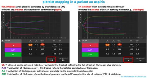 Coagulation Tests Conventional And Viscoelastic Emcrit Project