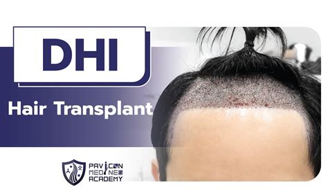 Dhi Hair Transplant Pavicon Mediness Center