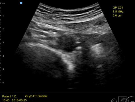 Image Gallery Echogen Portal Image Gallery Echogen Portal