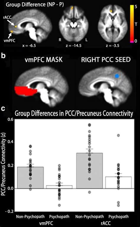 Psychopathic Brain Scans