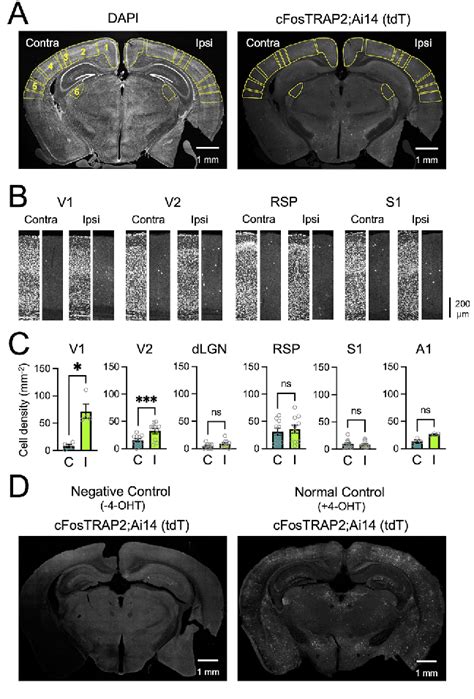 Figure 3 From Transcranial Low Intensity Focused Ultrasound Stimulation
