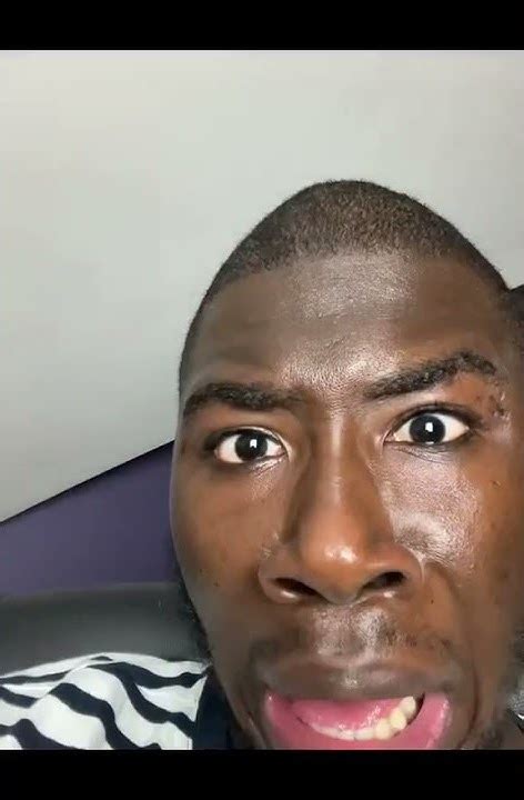 Guy With Dent In Head Meme Youtube