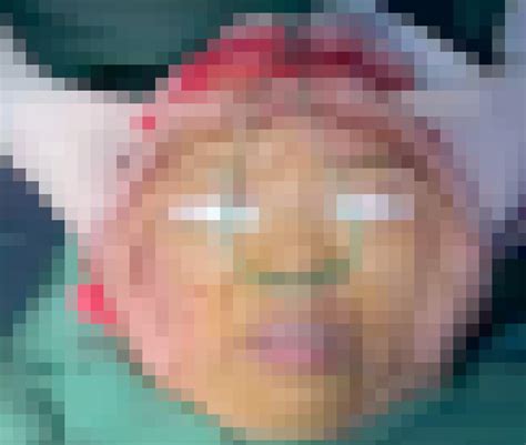 【閲覧注意】美容整形の裏側…フェイスリフトで ”顔が外れる” 動画が拡散中 ポッカキットポッカキット