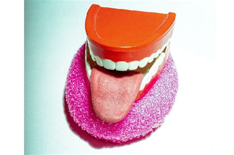 Macroglossia Causes Symptoms Treatment Complications