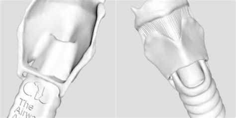 Surgical Airway Cricothyrotomy Aka The Emergent Cric