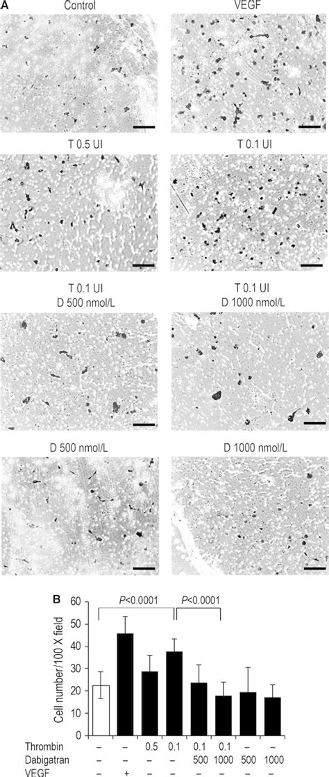Dabigatran Antagonizes Thrombin Driven Chemotaxis Of Mda Mb231 Cells
