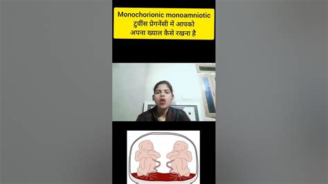 Monochorionic Monoamniotic Twins Pregnancy Me Aapko Apna Khyal Kaise