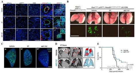 Cancer Cell 实锤！肿瘤微环境细胞衰老促进肿瘤进展 知乎
