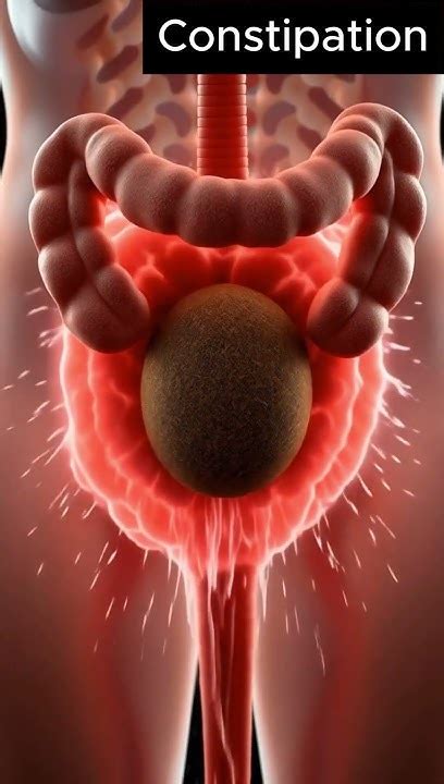 Slow Motion Constipated Stool Exit Human Anatomy 126 Youtube