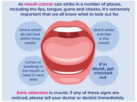 What Does Floor Of The Mouth Cancer Look Like
