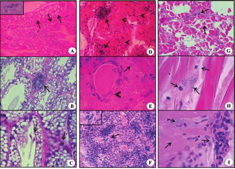 Cortes Histológicos De Hepatopáncreas órgano Linfoide Músculo En L