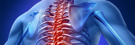 Osteochondrose Symptome Ursachen Therapie Herbano Йога для