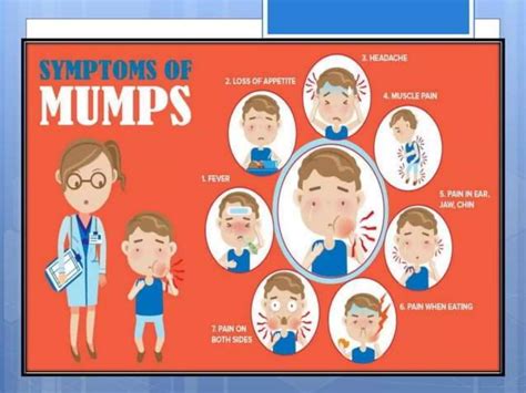 Mumpspptx