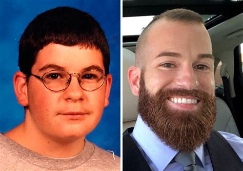 40 Ugly Ducklings” Youll Barely Recognize After Their Amazing